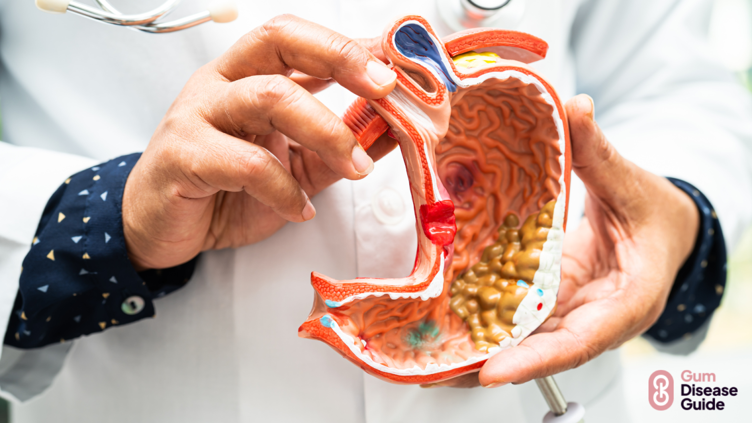 Has Gum Disease Caused You Stomach Issues?