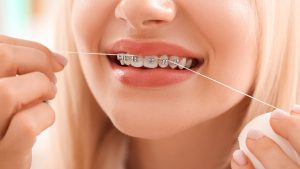 Interdental Cleaning: The Best Way To Clean Between Your Teeth!